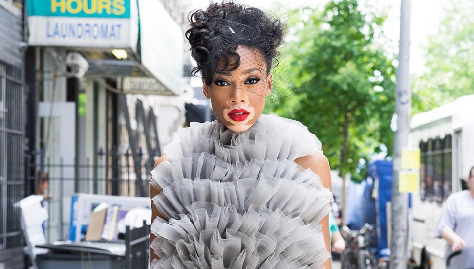 10 Atypical Models Who Are Redefining Beauty | Preview.ph